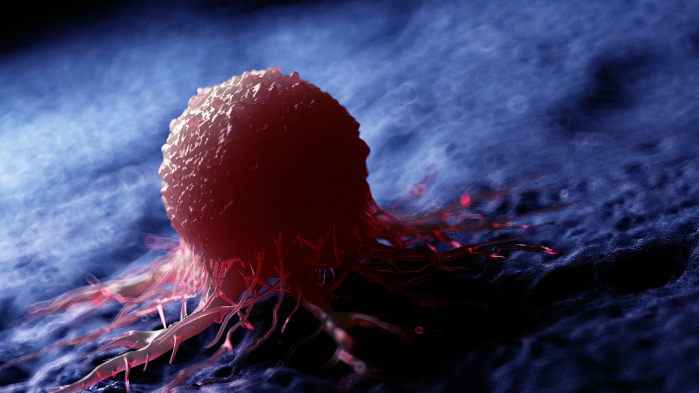 UH Seidman Cancer Center joins Caris Precision Oncology Alliance