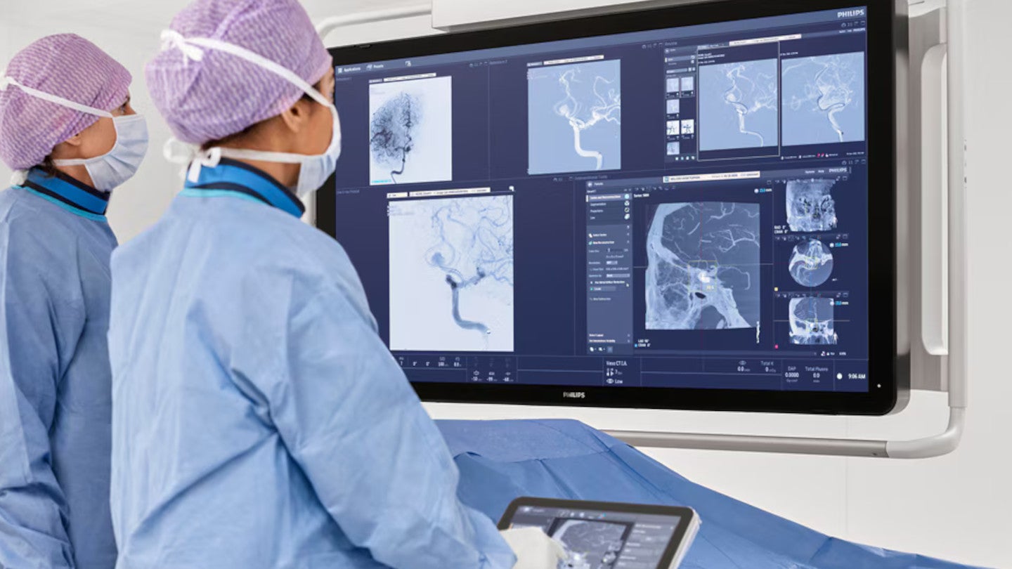 Methodist Hospitals invests in Philips’ IGT solutions